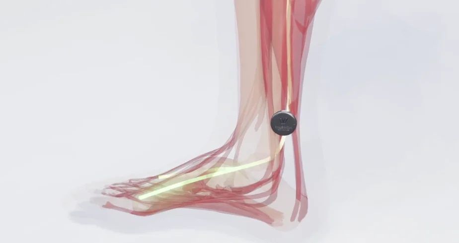 eCoin® Therapy: A Revolutionary Approach to Overactive Bladder ...