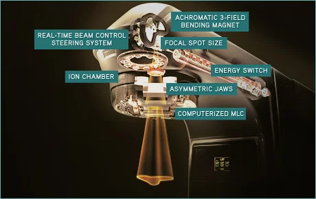 IGRT / IMRT for Prostate Cancer | Unio Specialty Care