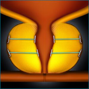 Urology Services | Unio Specialty Care